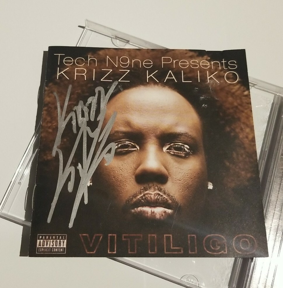 Krizz Kaliko Eye Condition