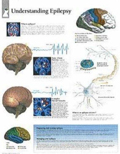 Understanding Epilepsy Paper Poster by Scientific Scientific Publishing ...