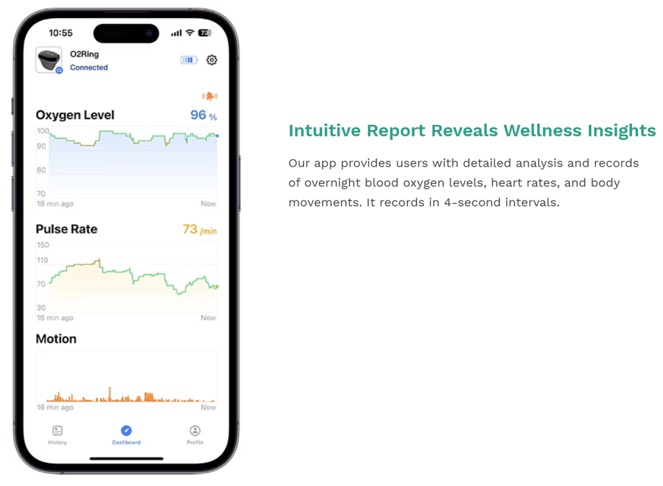 Wellue O2Ring PO2 Wearable Oxygen Monitor - New/Sealed | eBay