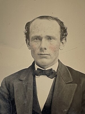 Hand-Colored Tintype Portrait Of An Irish Gentleman With Freckles | eBay