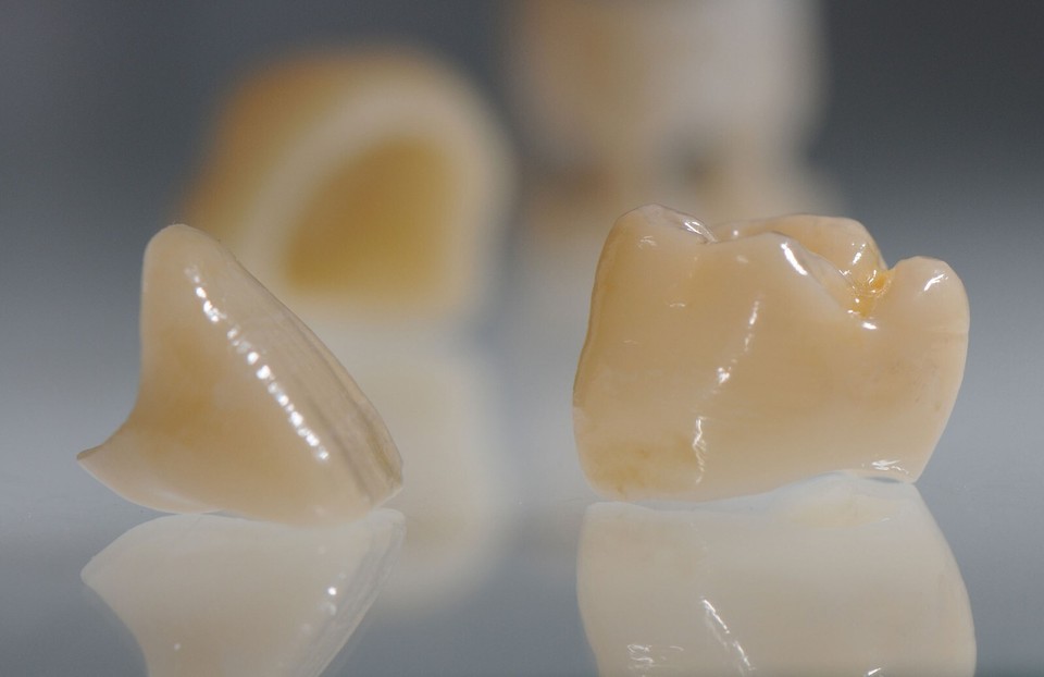 VarseoSmile Crown Plus by BEGO- 3D Printing Dental Resin - Permanent ...