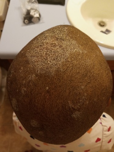 Ringworm Cream Fast Acting 100 Natural Plant Based Safer Than OTC ...