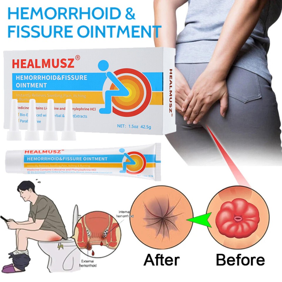 Hemorrhoids Remove Ointment Herbal Cream Relief Piles Pain Reduce ...