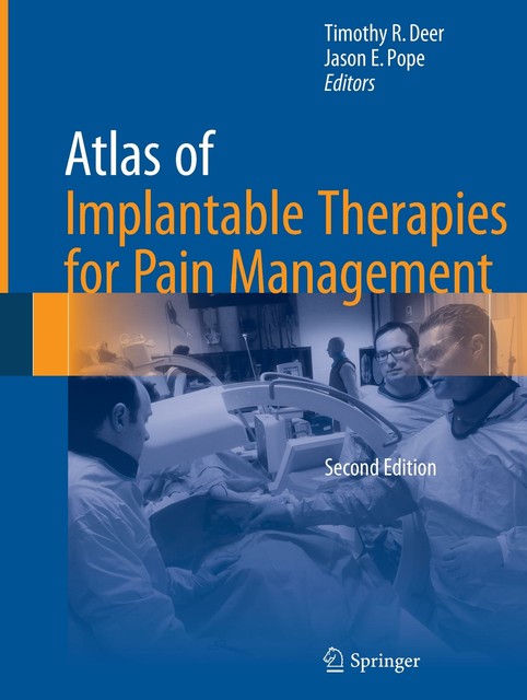Atlas of Implantable Therapies For Pain Management von Jason E. Pope ...