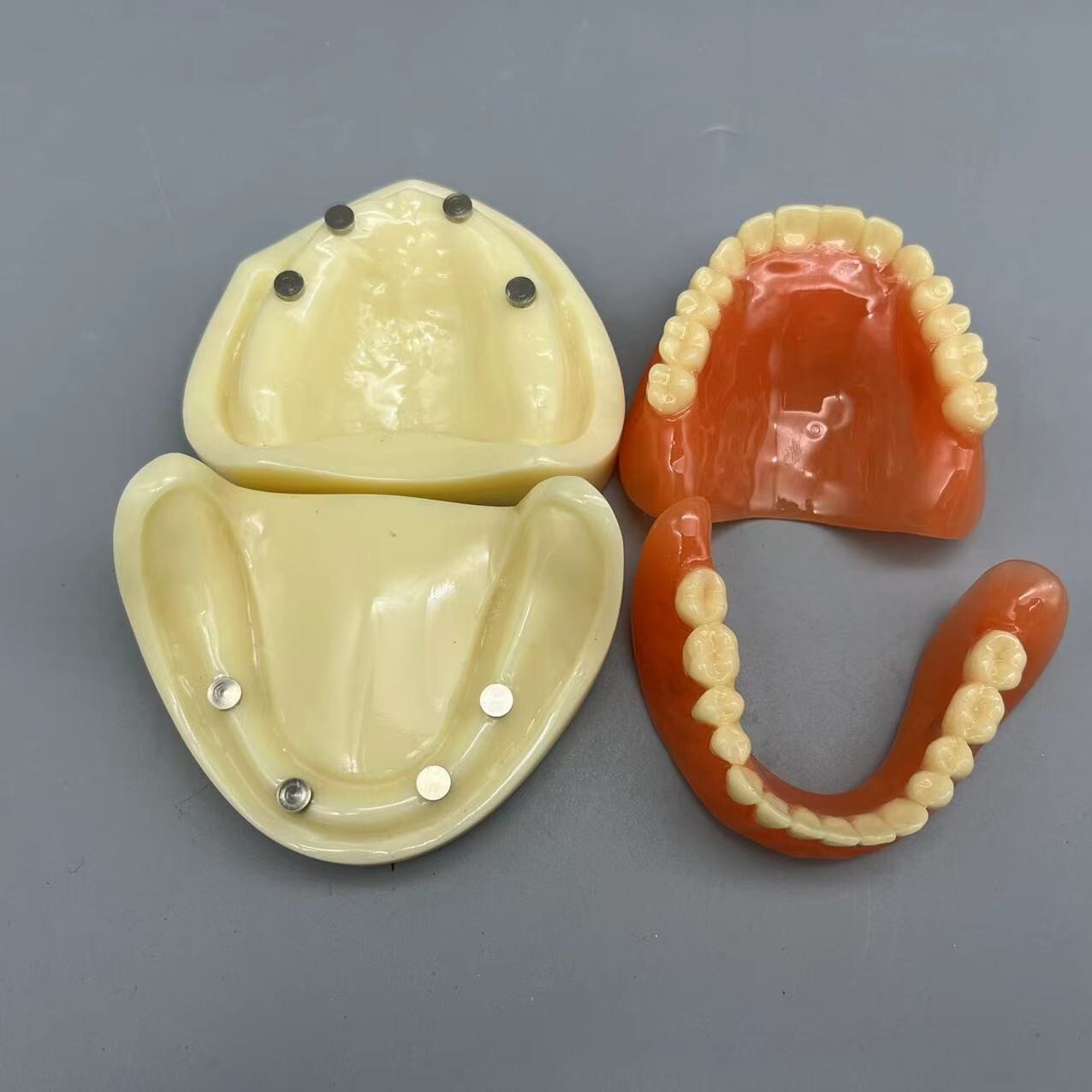 Dental 4 Implants Overdenture Typodont Restoration Upper lower Lower ...