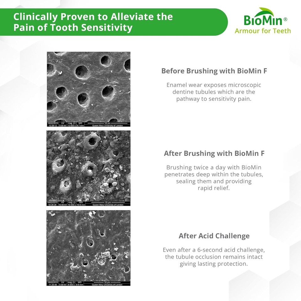 BioMin F Toothpaste (75ml) - Award winning - Armour for sensitive teeth ...
