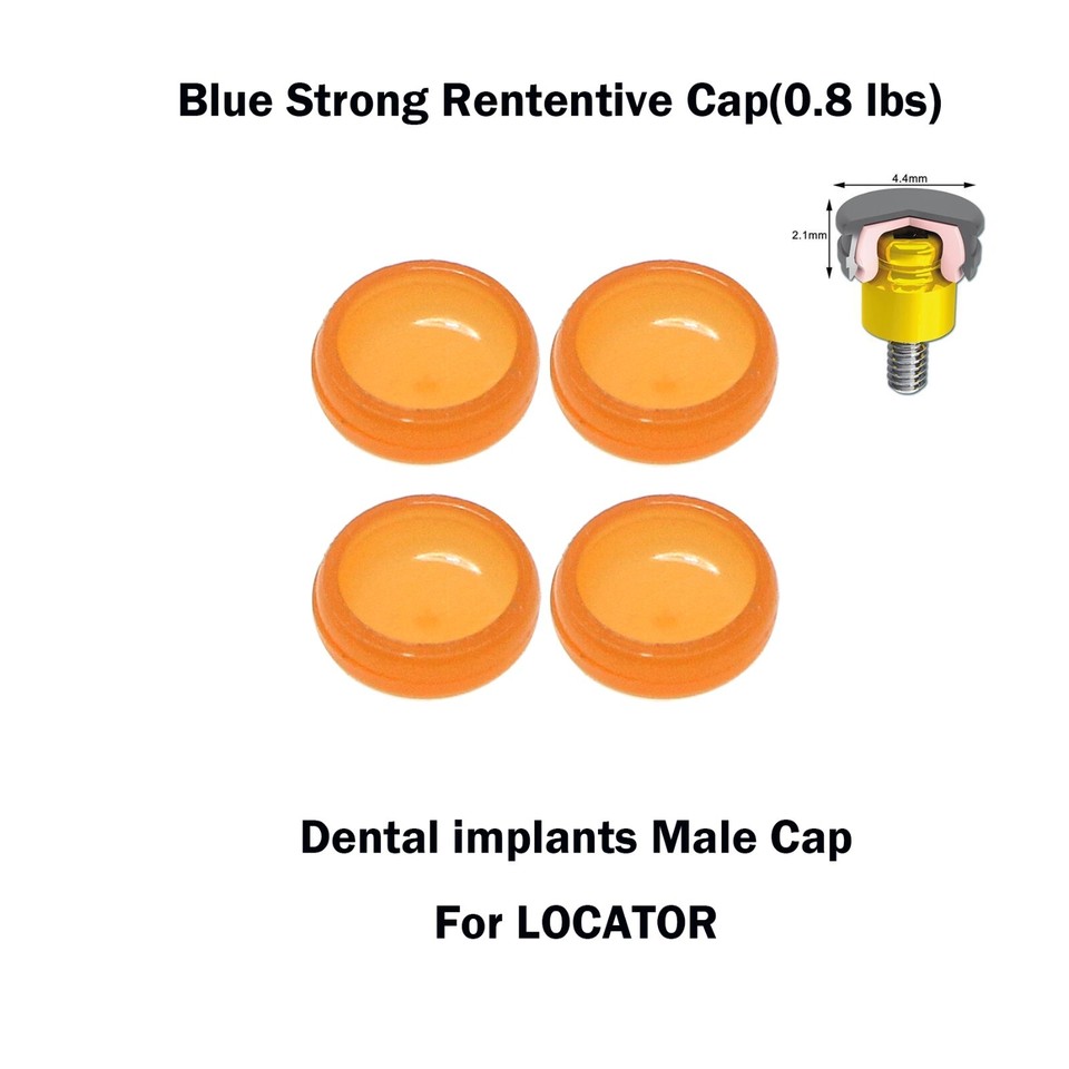 US Overdenture Attachment Abutments Locator 0.8Lbs Male Caps For ...