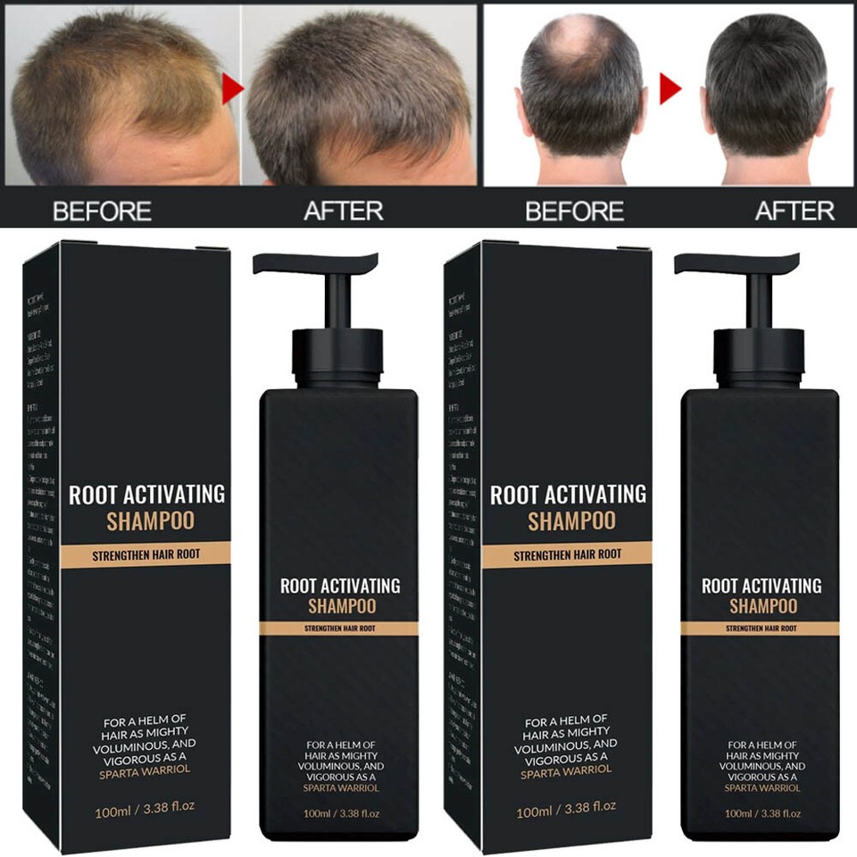 1-3PCS Root Activator Shampoo, SPARTAN Hair Loss Shampoo,Shampoo Root ...