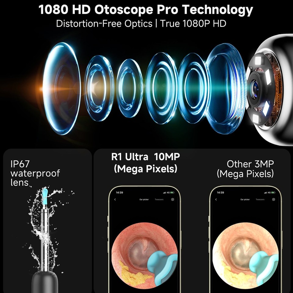 R1 Ultra Ear Wax Removal, Ear Cleaner with Camera Ear Scope, Wax Remove ...