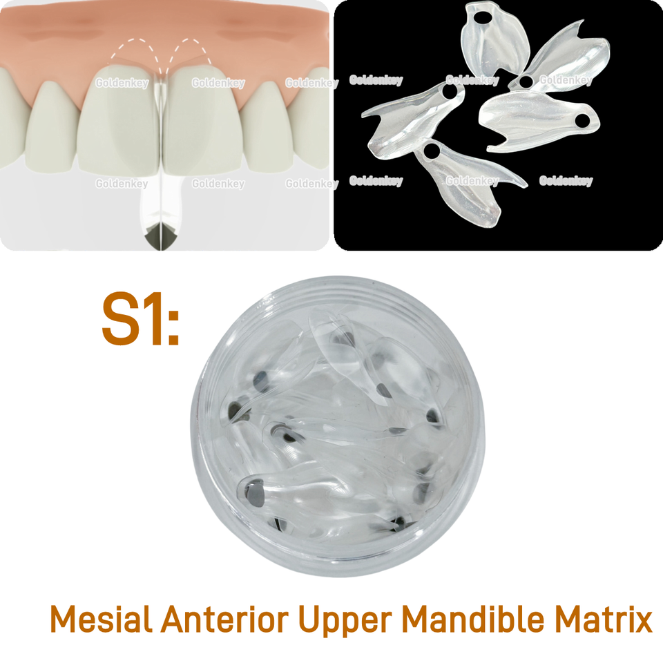 Transparent Matrix Clear Dental Bow Matrice Band Anterior Front ...