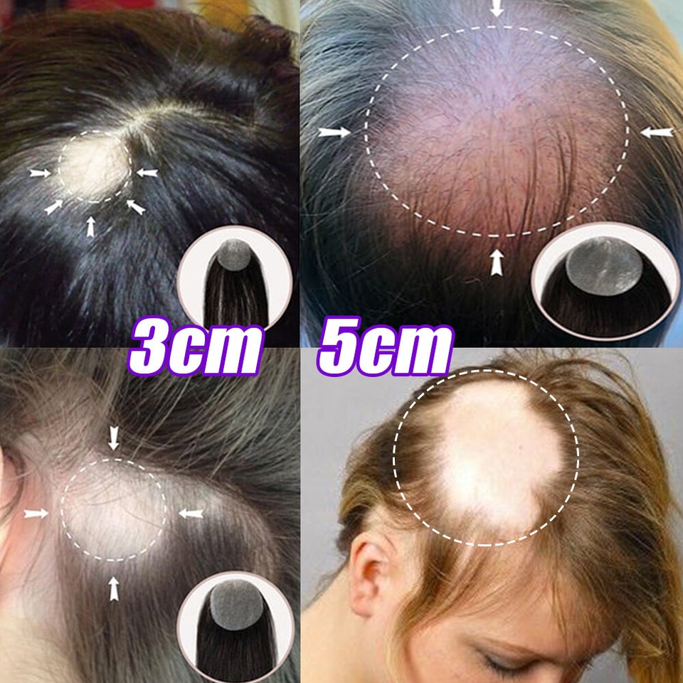 US Cover-up Tape Human Hair Patch Bald Spot Hairpiece Toupee For ...