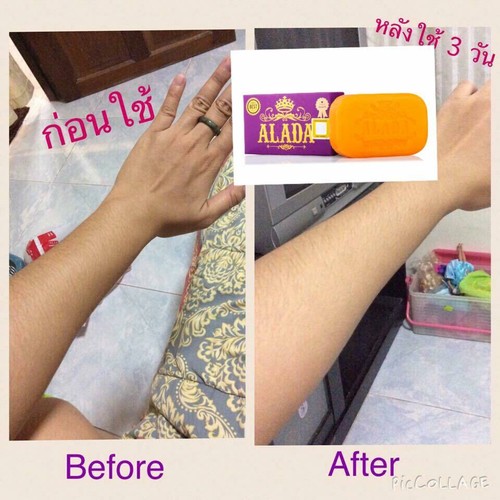 ALADA Super Fast Whitening Skin x10 Soap & Booster Lotion Set (USA 🇺🇸 ...