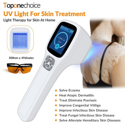 308nm Excimer Light Therapy Blue Light Therapy Wand UVB Light Therapy ...