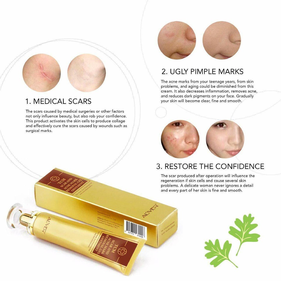 TCM Scar Acne Removal Gel Ointment Stretch Marks Old Scars Burns Repair ...
