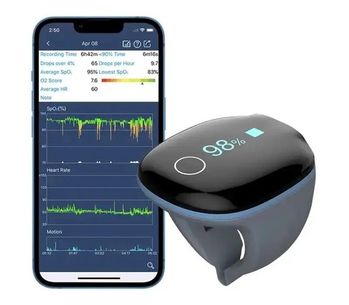 Wellue Ring Pulse Oximeter Heart Rate Monitor Continuous SpO2 Recording ...