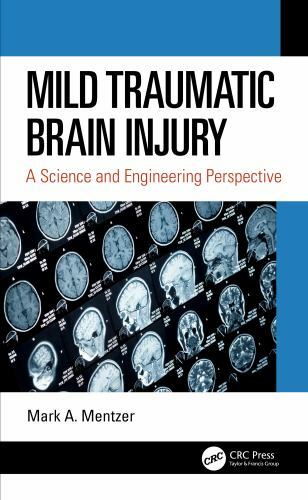 Mild Traumatic Brain Injury: A Science and Engineering Perspective ...