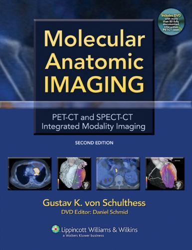 Molecular Anatomic Imaging: PET-CT And SPECT-CT Integrated Modality ...