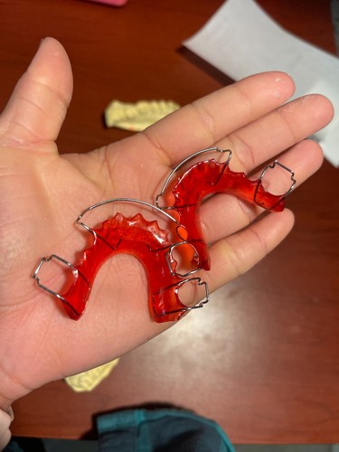 CUSTOM HAWLEY RETAINERS/Orthodontic Dental Braces ( FREE shipping & Imp ...