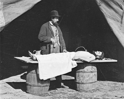 New 11x14 Civil War Photo: Embalming Surgeon at Work on a Federal ...