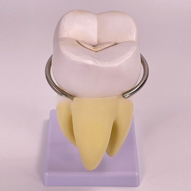 Molar Tooth Model, Detachable Tooth Anatomy Model for Scientific ...