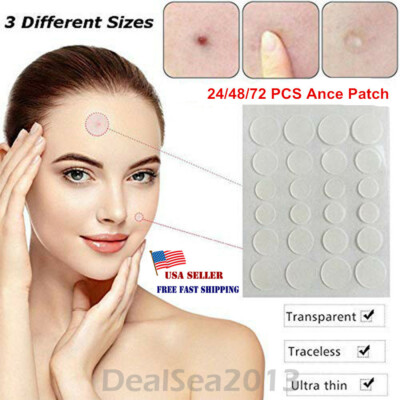 Skin Tag & Acne Patch - NEW Hydrocolloid Acne and Skin Tag Remover ...