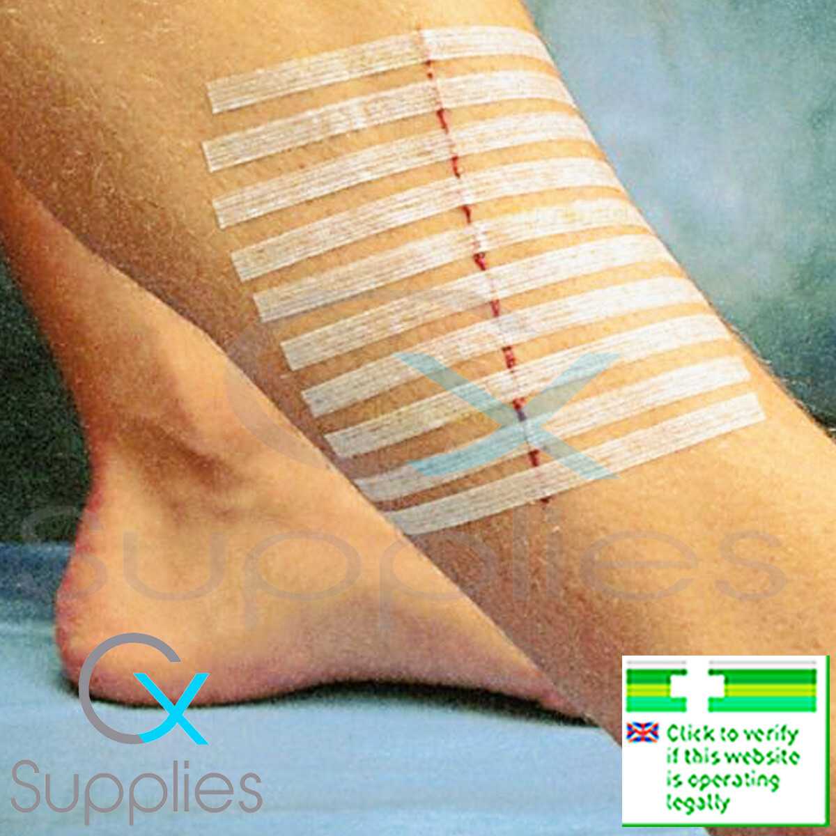 ⭐1 x 10 Sterile Wound Closure Strips⭐Skin Steri-Strips 3mmx75mm CE ...