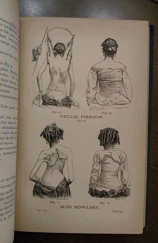 Rare Early Antique Medical Book Oddities Surgery Disorders Freaks ...