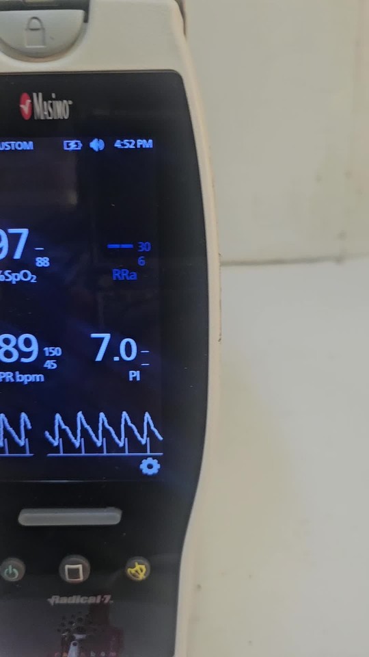 Masimo Radical 7 Rainbow Pulse Oximeter SpO2 -Dock -New Finger Clip ...