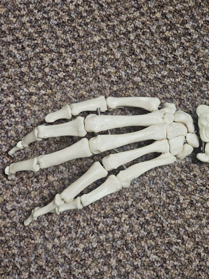 SCIENTIFIC Human Upper Limb Skeleton Anatomical Model, Life Size Arm ...