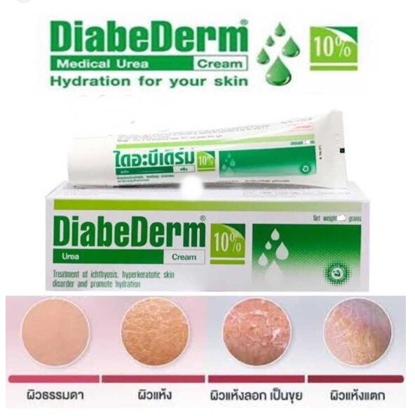 Dry Skin Treatment Promotes Hydration of Keratin Diabederm Urea Cream ...