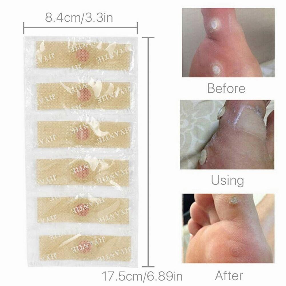 Effective Corn and Callus Removal Pads 648Pcs Plantar Wart Thorn ...