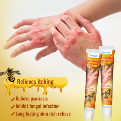 Bee Venom Psoriasis Cream Dermatitis Eczema Pruritus Ointment Skin Anti ...