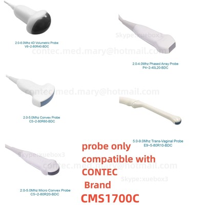 Linear/4D probe/ Cardiac (Phased array)Convex/Transvaginal/Cavity for ...