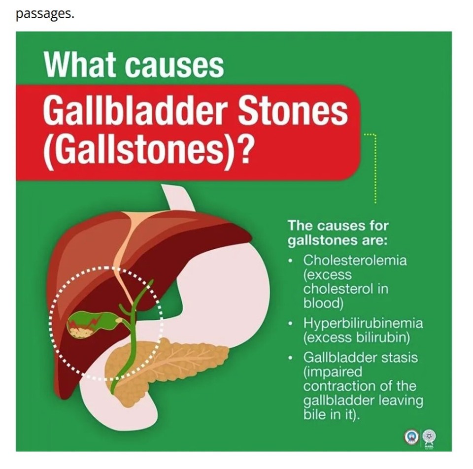 NATURAL HELP FOR GALLBLADDER STONES - HERBAL FORMULA FOR GALLSTONES ...