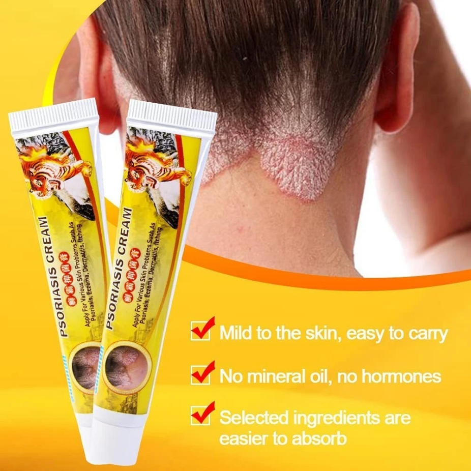 Health Care Psoriasis Cream Eczema Ointment Scalp Psoriasis Hand Tinea ...