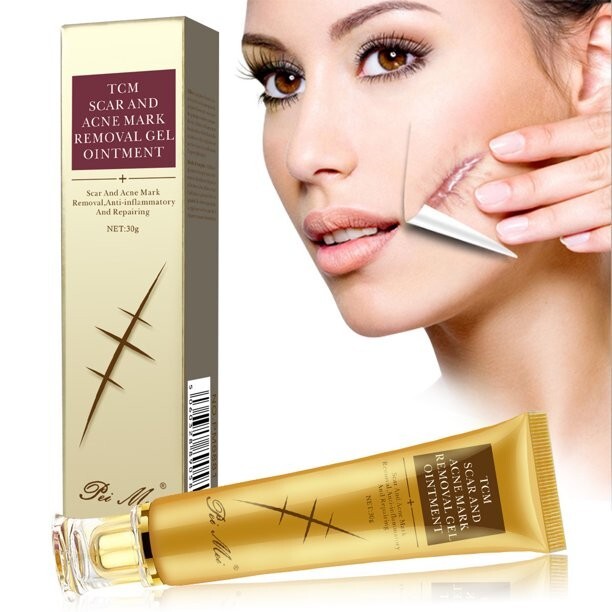Scar and Acne Mark Removal Gel Ointment Remove Scars Burns Stretch ...