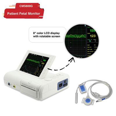 Prenatal Heart Monitors - Prenatal Ultrasound