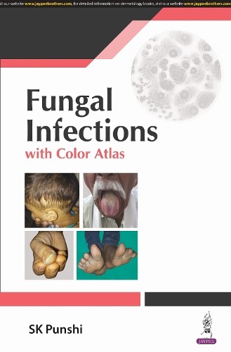 SK Punshi Fungal Infections (Paperback) (UK IMPORT) | eBay