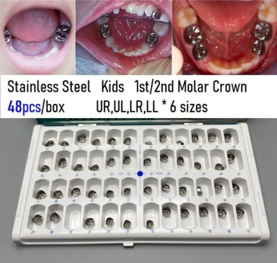 Dental Kids Crown 1st 2nd Molar Stainless Steel Refill Premolar ...