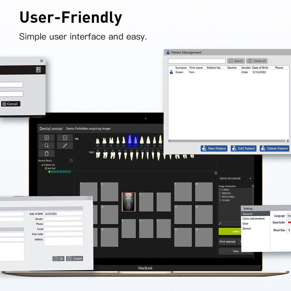 Dental Digital RVG X-Ray Sensor Image System Intraoral HD XRay Sensor ...