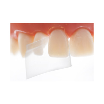 PROXYPAL UNIVERSAL 3D ANTERIOR MATRIX BAND - 36/PACK - DIRECTA DENTAL ...