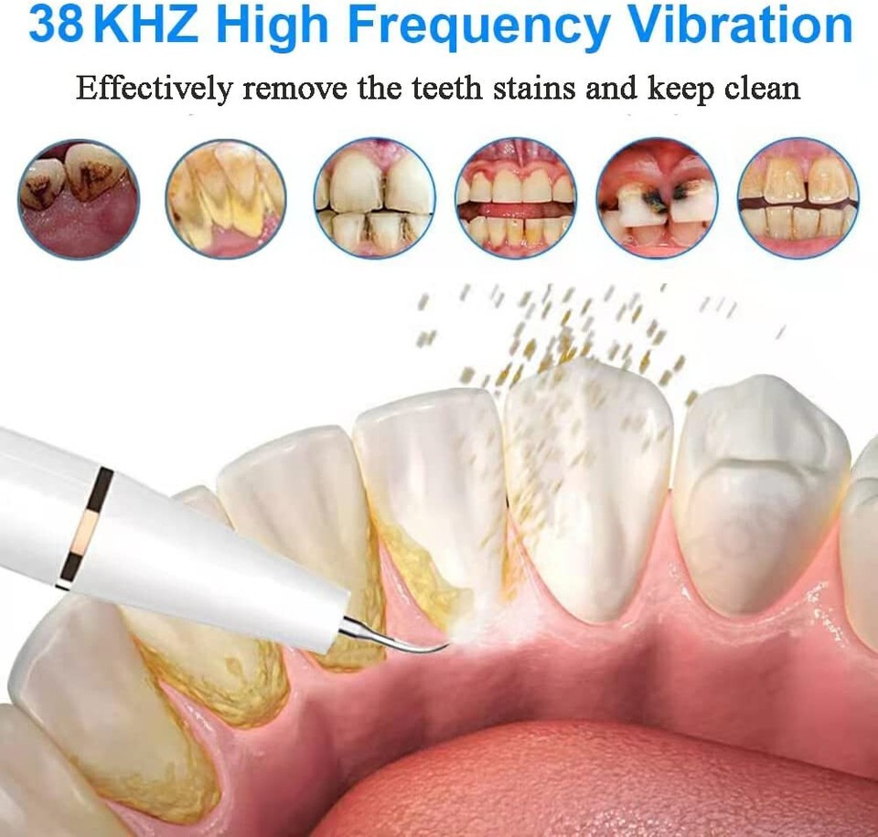 Ultrasonic Tooth Dental Plaque Calculus Stain Remover Teeth Cleaning ...