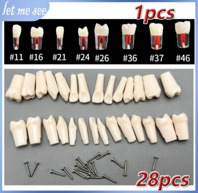 Dental Replacement Teeth W Screw /Root Canal Practice Model RCT Model ...