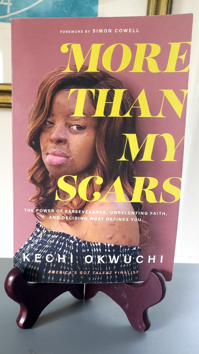 NEW More Than My Scars: Power of Perseverance/Faith FORWARD BY Simon ...