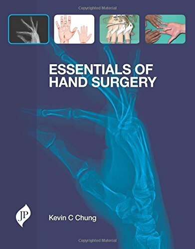Essentials of Hand Surgery by Chung New 9781907816321 Fast Free ...
