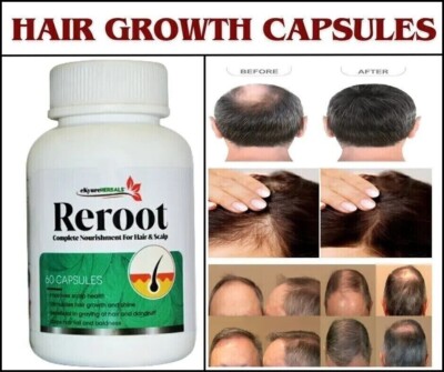 Hair Growth Vitamins For Men - Anti Hair Loss Pills. Regrow Hair ...