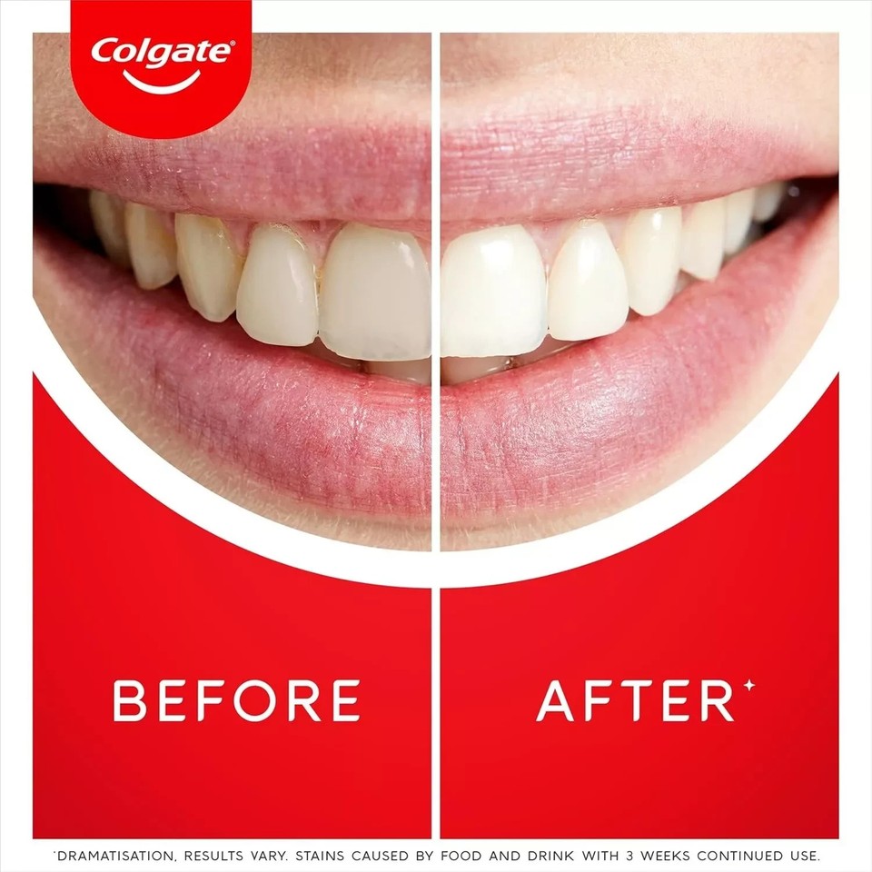 COLGATE Max White Ultimate ultra Catalyst Toothpaste 75 ml Whiter in 3 ...
