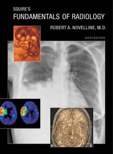 Squire's Fundamentals of Radiology by Robert A. Novelline (2004 ...