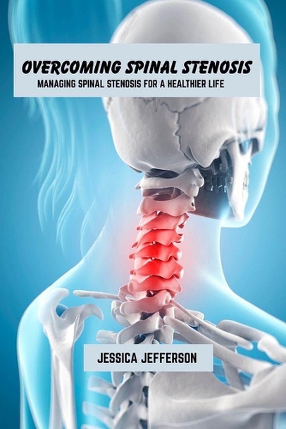 Overcoming spinal stenosis: Managing spinal stenosis for a healthier ...
