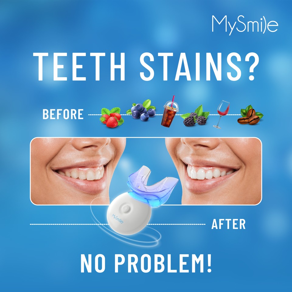 MySmile PAP Teeth Whitening Kit with 5LED Light Upper Lower Tray ...